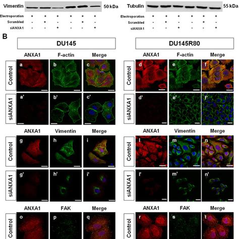 Anxa1 Knockdown Effects On Du145 And Du145r80 Cell Invasion Capability