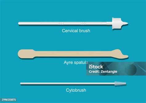 Cervical Cancer Screening Pap Smear Stock Illustration Download Image