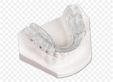 Splint Temporomandibular Joint Dysfunction Jaw Orthotics Twin Block Appliance Png 623x600px