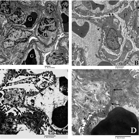 A An Electron Micrograph Demonstrating The Renal Glomerular Corpuscle