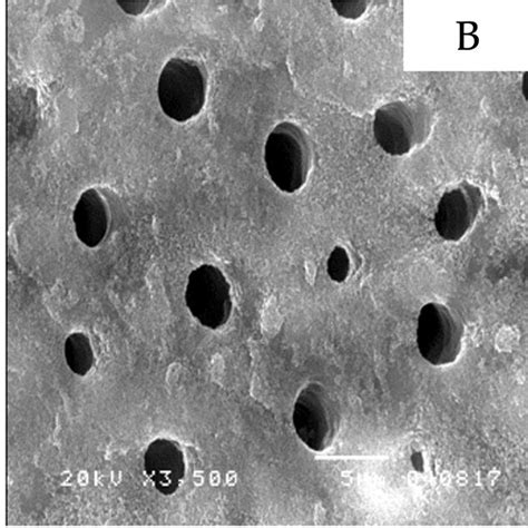 The Dentin Micro Morphology With 375 Percent Phosphoric Acid Applied