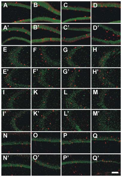 Immunohistochemical Detection Of Parvalbumin Pv Red Fluorescence In