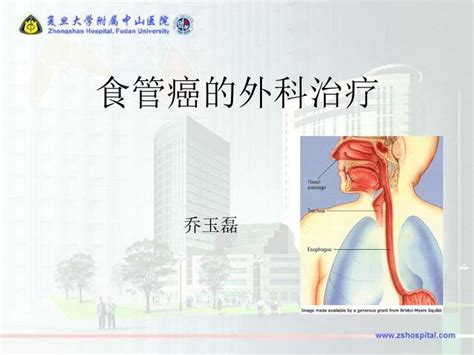 Ppt 食管癌的外科治疗 Powerpoint Presentation Free Download Id 5552105