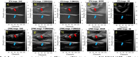 Specular Reflection In Ultrasound At Emily Jenkins Blog