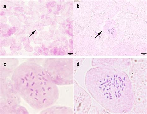 Photomicrographs Of Squash Preparations Of Root Tip Cells Obtained From