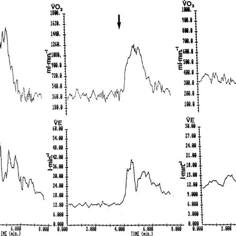 Original Recording From One Subject Showing Oxygen Uptake V O 2