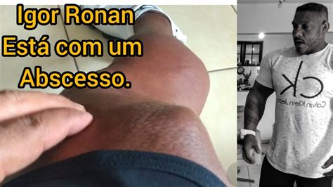 Estou Com Um Abscesso Youtube