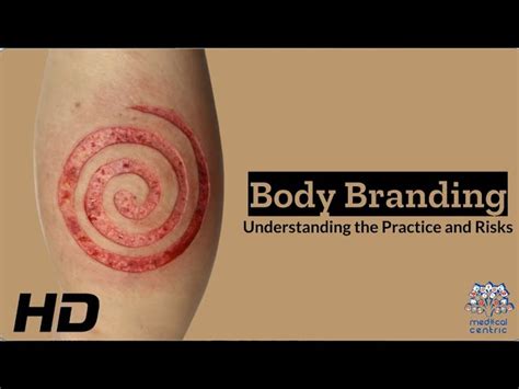 Human Branding Healing Process