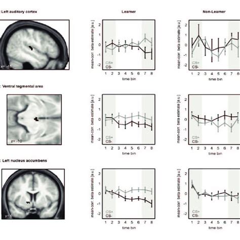 Bold Activity During The Reward Anticipation Phase Left Side Regions Download Scientific