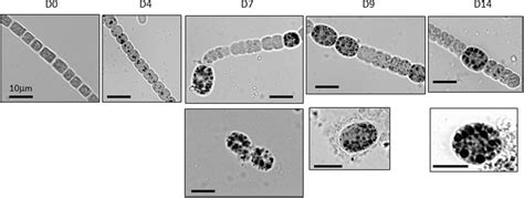 Accumulation Of Cyanophycin Globules Cg In Vegetative Cells And Download Scientific Diagram