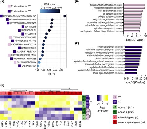 RTs Display A Strong Epithelialmesenchymal Transition EMT Profile