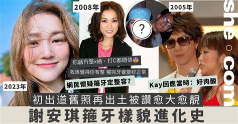 謝安琪初出道箍牙舊照曝光 自認當時任性箍牙「好肉酸」
