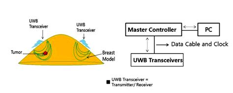 Schematic Representation Of Breast With Tumor Signal Transmission With Download Scientific
