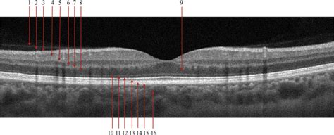 Structure Of The Posterior Segment Of The Eye As Visualized With Oct