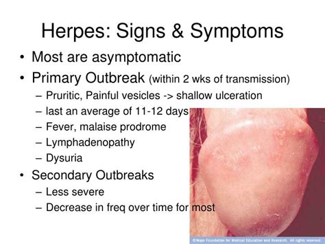 Ppt Std Overview Powerpoint Presentation Id 5744461