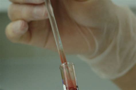 CDC More Than K People Infected With HIV Don T Know They Have It UPI