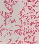 Gram Negative Bacilli Flashcards Quizlet