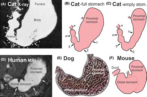 Proximal Vs Distal Stomach