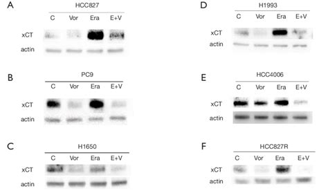Vorinostat Suppressed The Expression Of Xct In Egfr Activating Mutant