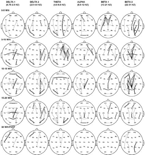 Effect Of Twice Dominant Alpha Stimulation On Eeg Coherence Dark Red
