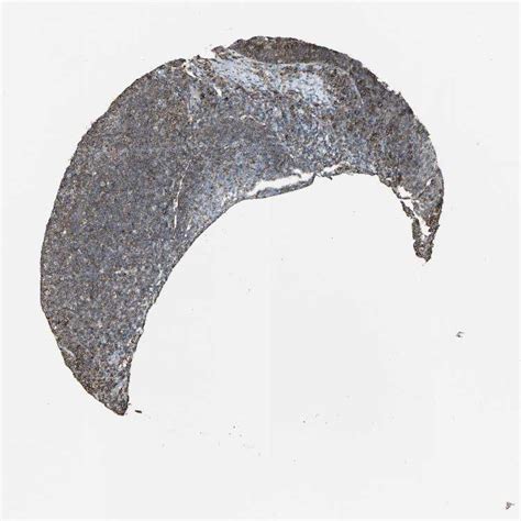 Tissue Expression Of Cd44 Staining In Tonsil The Human Protein Atlas