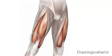 8 تمرین ورزشی فوق‌العاده برای تقویت عضلات چهار سر ران دکتر امین جواهری