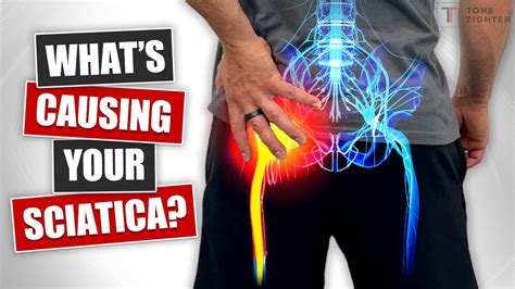 Whats Causing Your Sciatic Nerve Pain Tests And Treatment For
