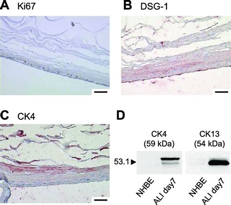 Expression Of Markers On Stratified Squamous Epithelial Cells A Ki 67