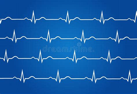 Heart Normal Sinus Rhythm On Electrocardiogram Stock Vector