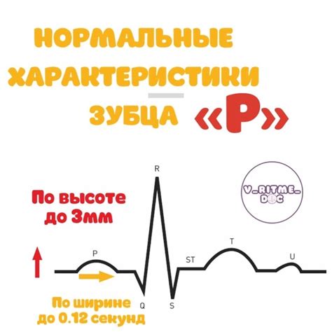 ЗАПОМИНАЕМ НОРМАЛЬНЫЕ ХАРАКТЕРИСТИКИ ЗУБЦА P ️в НОРМЕ зубец P обычно в ...