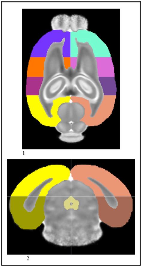 2 The P14 Cortex Divisions In The Md With The Central Gray Tan The