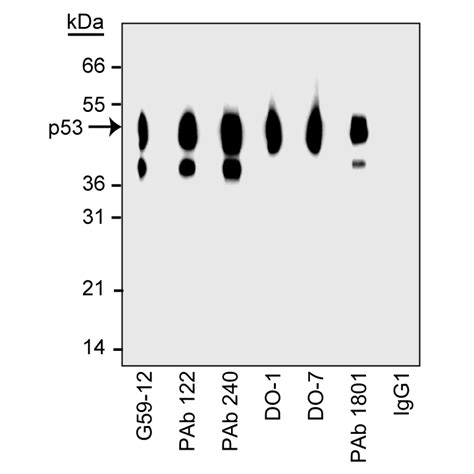 Recombinant Human P53 Protein Wildtype
