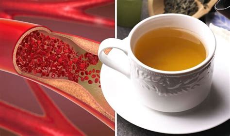 Iron Deficiency Tea Consumption Could Interfere With Iron Absorption