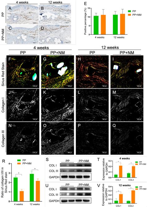 Modification Of Transvaginal Polypropylene Mesh With Co Axis Electrospun Nanofibrous Membrane To