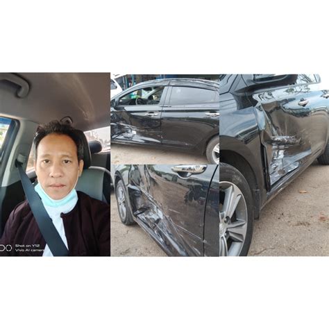 ယာဉ်မတော်တဆမှုကြောင့် ကားတစ်စီးလုံးနီးပါးပျက်ဆီးသွားခဲ့လို့ စိတ်ထိခိုက