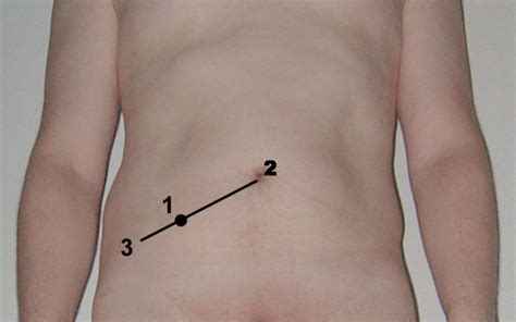Test Your Anatomy Knowledge The Abdomen Medical Exam Prep