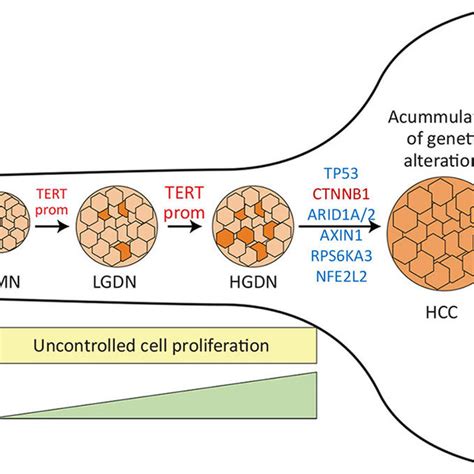 The Multistep Process Of Carcinogenesis On Cirrhosis The Role Of Tert