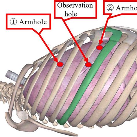 Hole Layout Of Lateral Thoracic Approach Download Scientific Diagram