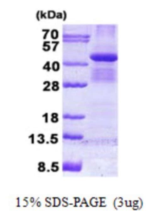 Novus Biologicals™ Recombinant Human Bub3 His Protein 01mg Fisher