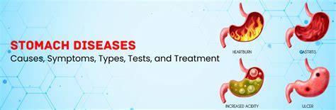 Common Stomach Diseases Causes Symptoms And Treatment