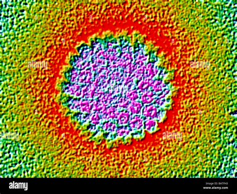 Human Papilloma Virus Hpv Coloured Transmissionelectron Micrograph