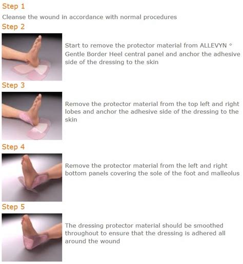 Allevyn Gentle Border Dressings By Smith And Nephew All Sizes