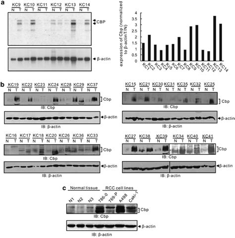 C Terminal Src Kinase Csk Binding Protein Cbp Expression In Renal Download Scientific
