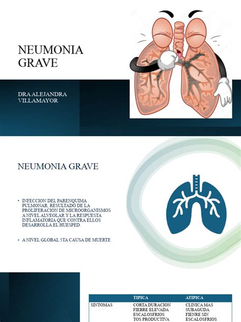Neumonia Grave Descargar Gratis Pdf Neumonía Especialidades Medicas