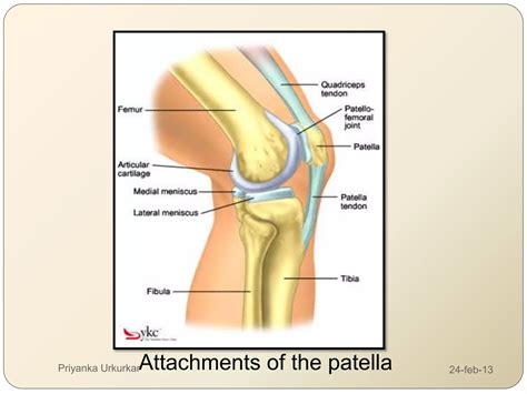 Patellofemoral Pain Syndrome Pfps Pptx