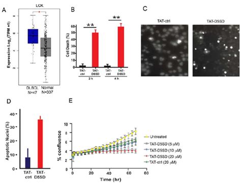 A Novel Peptide That Disrupts The Lck IP R Protein Protein Interaction Induces Widespread Cell