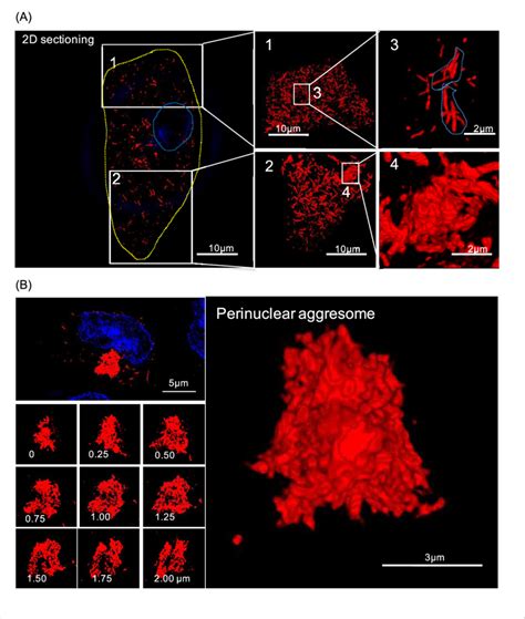 Super Resolved Structures Of Intracellular Arctic Mutant Aggregates Download Scientific