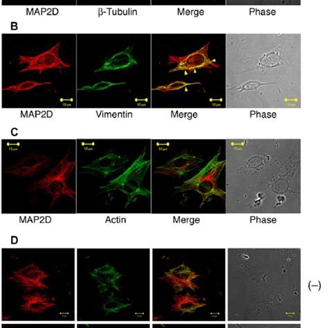 MAP2D Partially Colocalizes With The Vimentin Intermediate Filament And