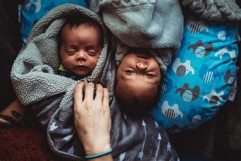 Mono Mono Risks Of Twins In Same Sac One Placenta