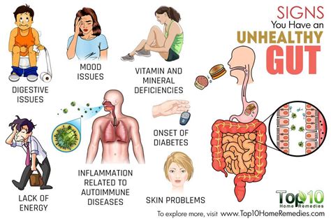 10 Signs You Have An Unhealthy Gut Top 10 Home Remedies